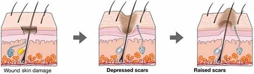 Top 2018 Acne Scars Specialists · Laser Dermatology · Dermatologist NYC